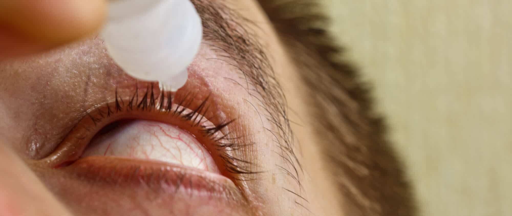 Suffering From an Eye Emergency? Here’s How to Tell - Art of Optiks
